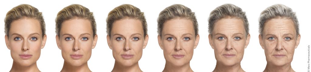 Hautalterung – Dermatologie Geilenkirchen